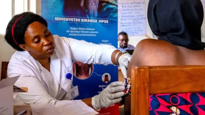 Rwanda yaanza zoezi la kutoa chanjo ya Mpox - Pars Today